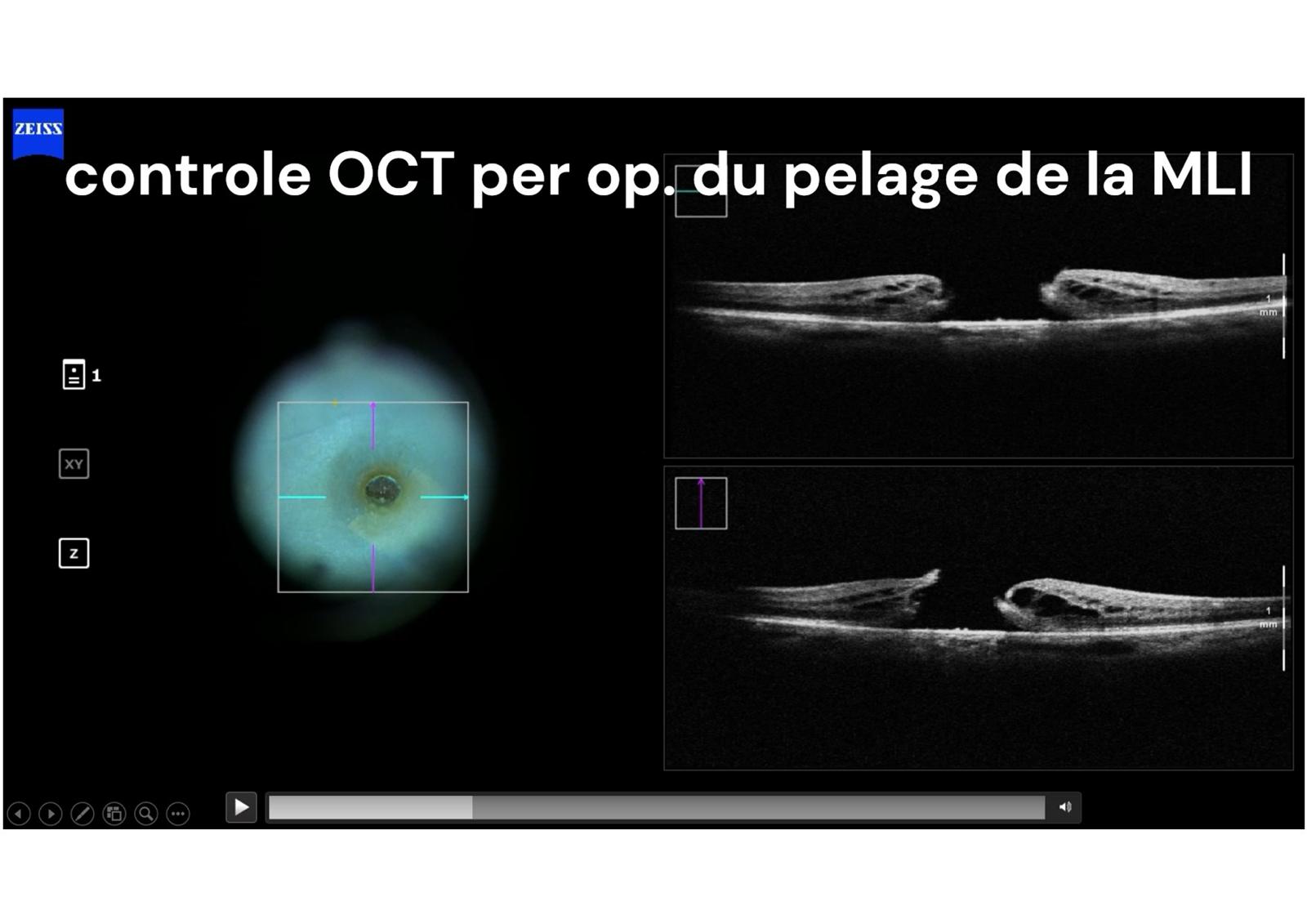 La Clinique des Yeux Bordeaux présente au congrès ophtalmologique de ...
